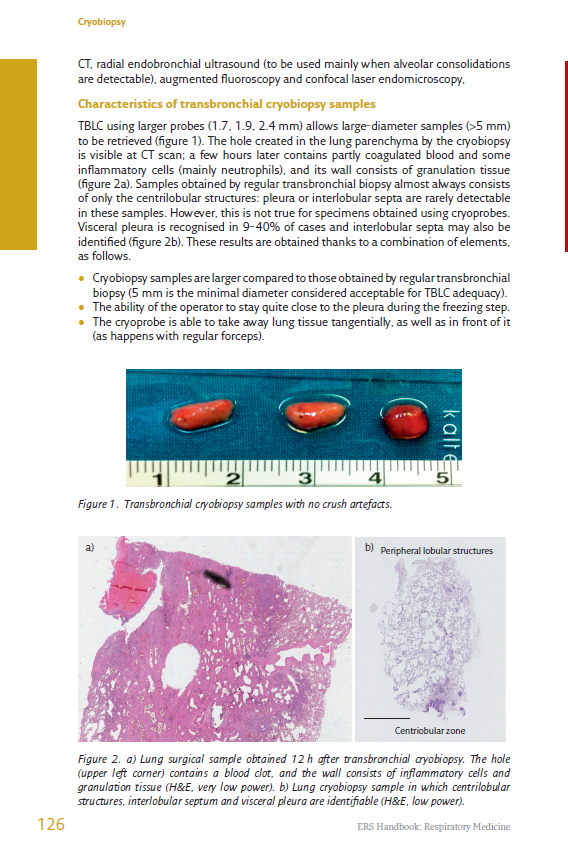 ERS Handbook | Respiratory Medicine 4th Edition – ERS Bookshop