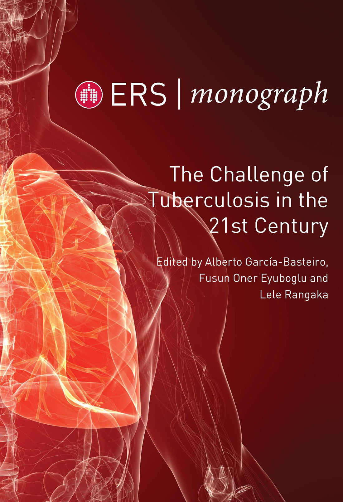 The Challenge of Tuberculosis in the 21st Century – ERS Bookshop